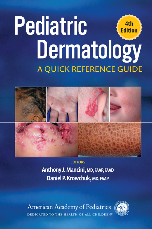Transient Neonatal Pustular Melanosis | Pediatric DermatologyA Quick ...