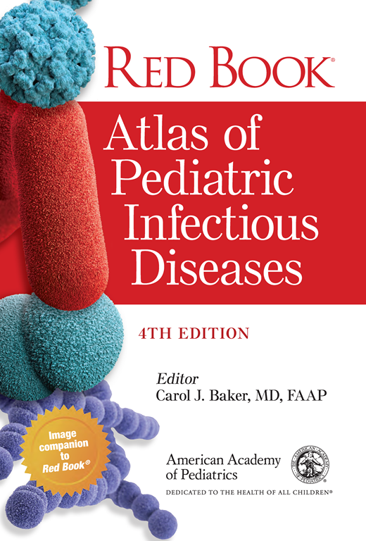 Tinea Cruris(Jock Itch) | Red Book Atlas of Pediatric Infectious ...