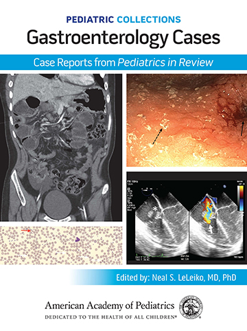 Chronic Constipation in a 7-year-old Boy | Pediatric Collections ...