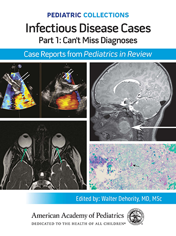 Pediatric Collections: Infectious Disease Cases, Part 1: Can’t Miss ...