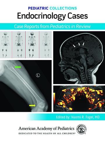 Left Leg Pain in a 9-year-old Boy | Pediatric Collections ...