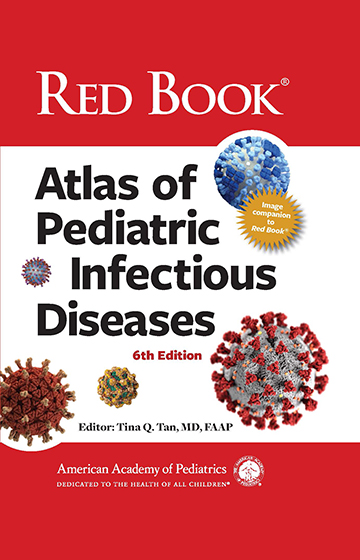 Rotavirus Infections | Red Book Atlas of Pediatric Infectious Diseases ...