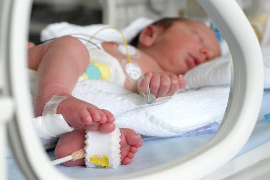 Answers to questions about coding for newborn intensive care, critical ...