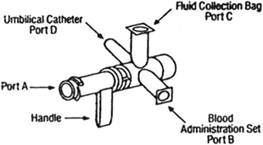 Double Volume Exchange Transfusion | NeoReviews | American Academy of ...