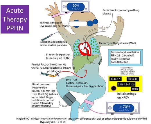 Persistent Pulmonary Hypertension of the Newborn | NeoReviews ...