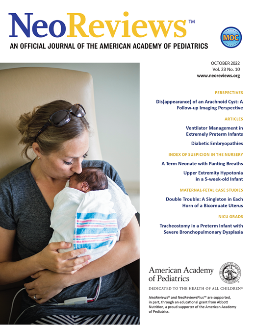 A Neonate with Dysmorphic Features and Respiratory Distress ...