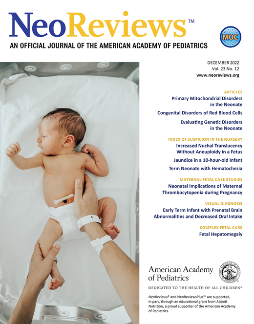 Early Term Infant with Prenatal Brain Abnormalities and Decreased Oral ...