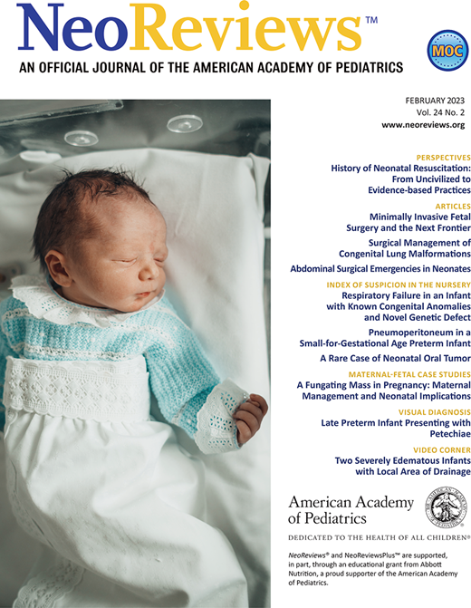 A Rare Case of Neonatal Oral Tumor | NeoReviews | American Academy of ...