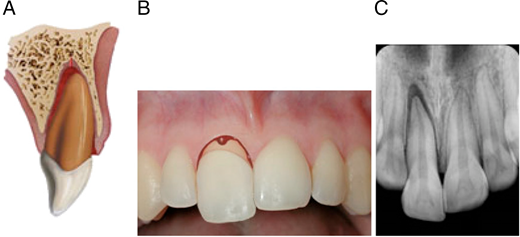 Management of Dental Trauma in a Primary Care Setting | Pediatrics ...