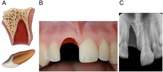 Management of Dental Trauma in a Primary Care Setting | Pediatrics ...