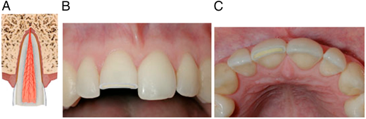 Management of Dental Trauma in a Primary Care Setting | Pediatrics ...