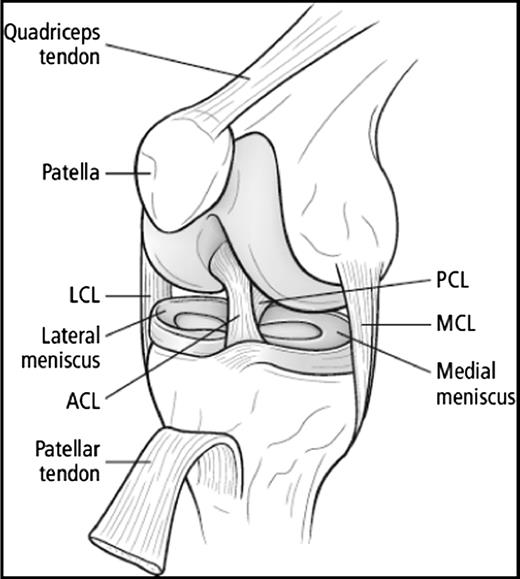 Anterior Cruciate Ligament Injuries: Diagnosis, Treatment, and Prevention | Pediatrics ...