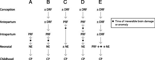Neonatal Encephalopathy and Neurologic Outcome, Second Edition ...