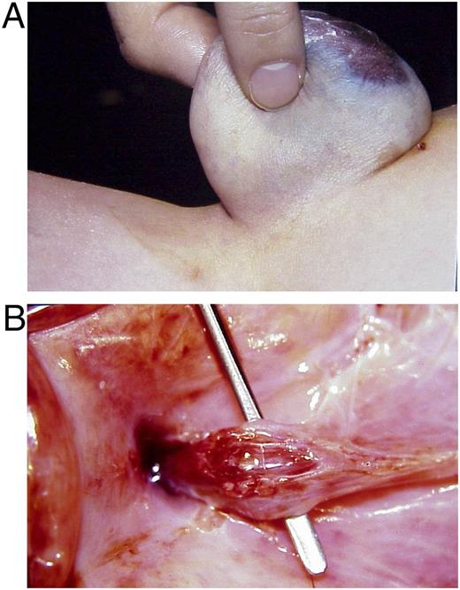 Congenital Brain and Spinal Cord Malformations and Their Associated ...