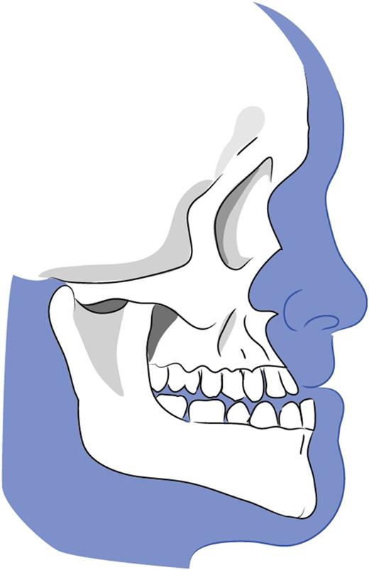 The Primary Care Pediatrician and the Care of Children With Cleft Lip ...