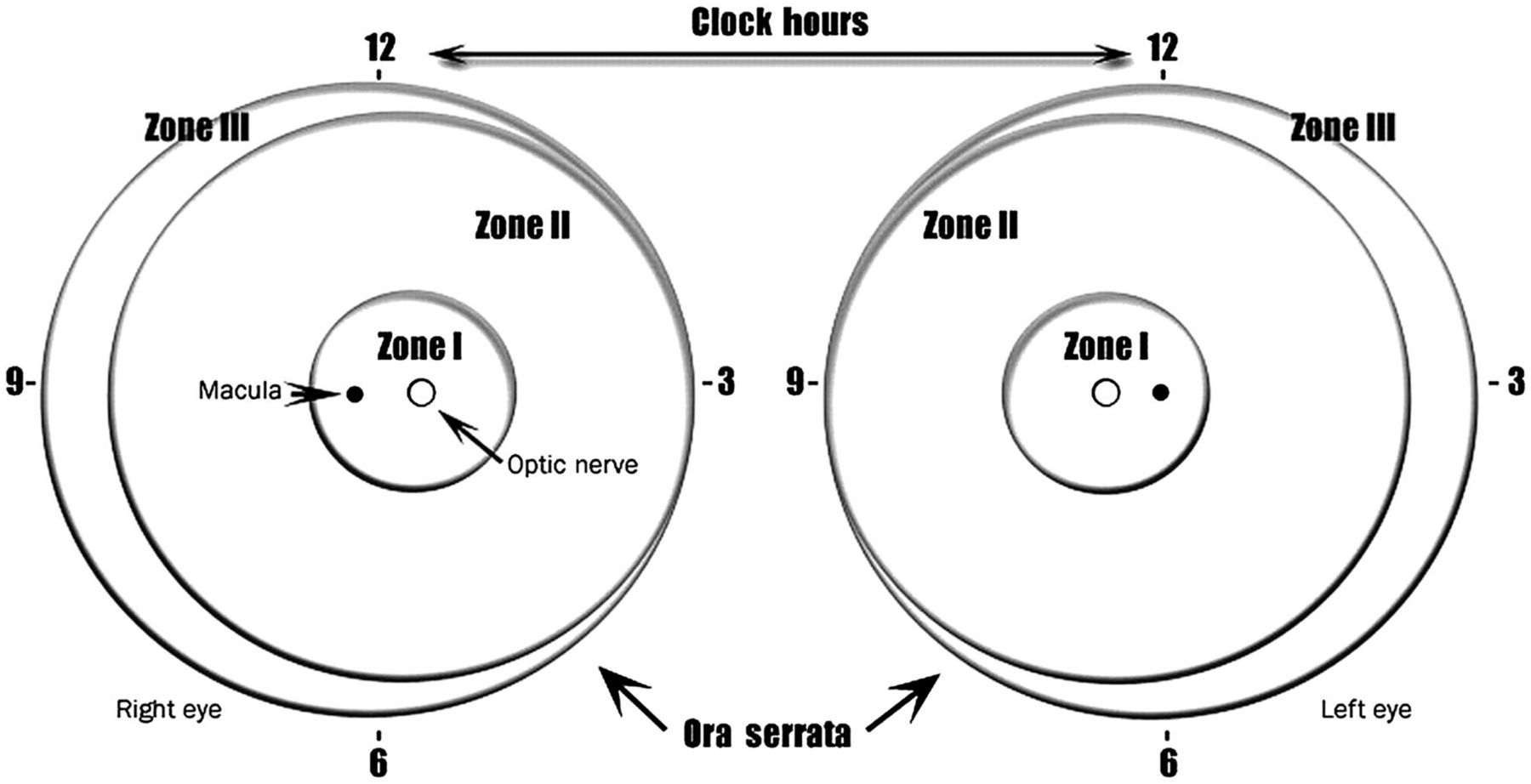 AAP Screening of Premature Infants for Retinopathy of Prematurity ...