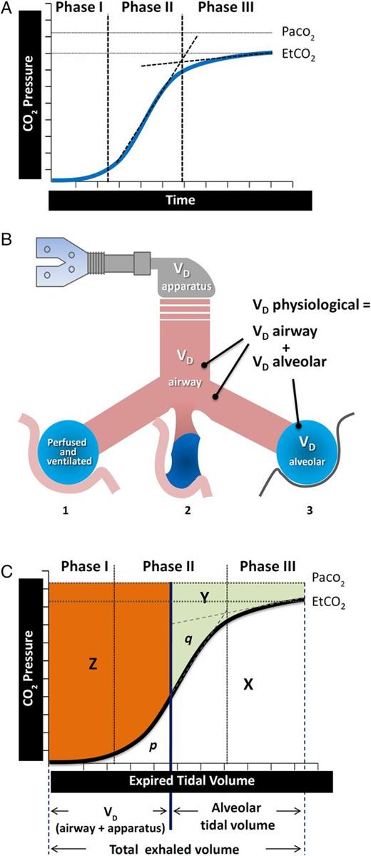 Continuous Noninvasive Carbon Dioxide Monitoring in Neonates: From ...