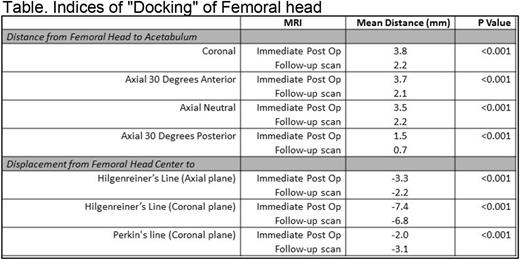 The “Docking” Theory following Closed Reduction for DDH: Does it Really ...