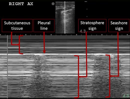 Moving Beyond the Stethoscope: Diagnostic Point-of-Care Ultrasound in ...