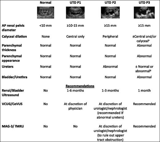 State-of-the-Art Renal Imaging in Children | Pediatrics | American ...