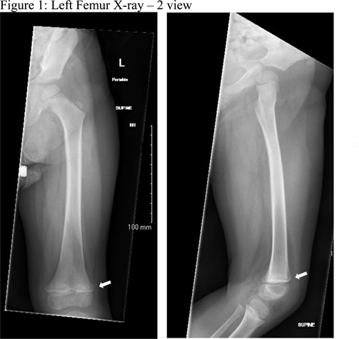 Refusal to Walk In A 2-Year-Old Female | Pediatrics | American Academy ...
