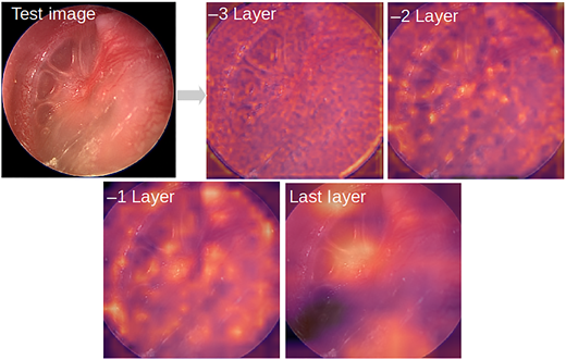 Machine Learning for Accurate Intraoperative Pediatric Middle Ear ...