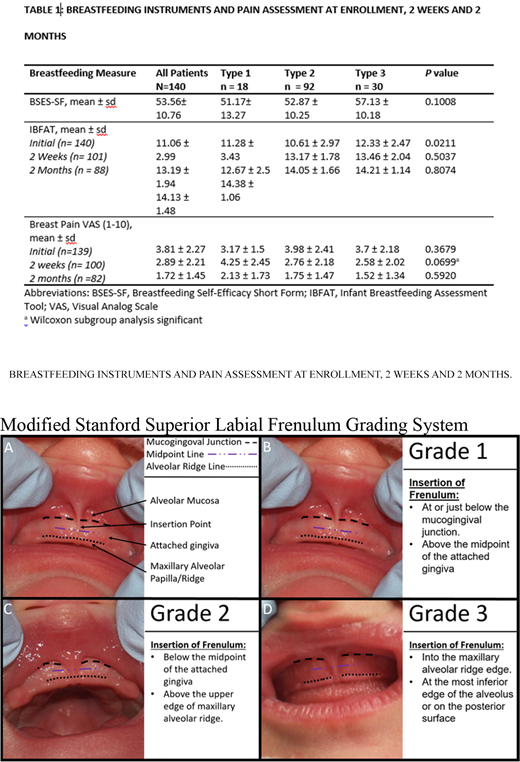 Superior Labial Frenulum Attachment Site and Correlation with Breast ...