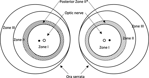 Retinopathy of Prematurity: A Global Perspective and Recent ...