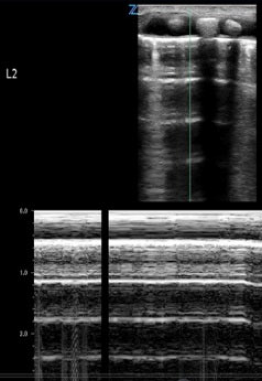 Use of Point-of-Care Ultrasonography in the NICU for Diagnostic and ...