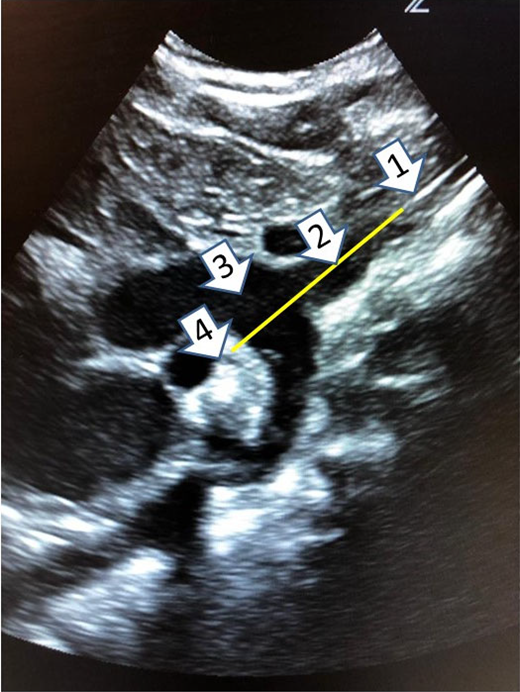 Use of Point-of-Care Ultrasonography in the NICU for Diagnostic and ...