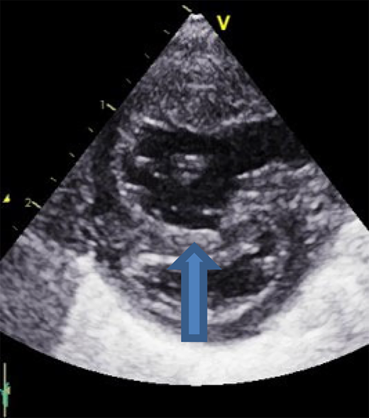 Use of Point-of-Care Ultrasonography in the NICU for Diagnostic and ...