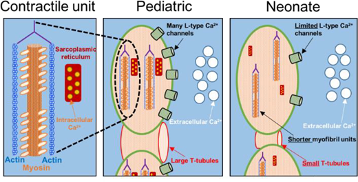 Preoperative Management of Neonates With Congenital Heart Disease ...