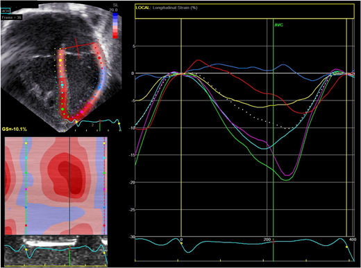 Targeted Neonatal Echocardiography in Patients With Hemodynamic ...