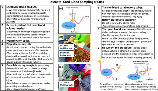 Postnatal Cord Blood Sampling: Clinical Report | Pediatrics | American ...