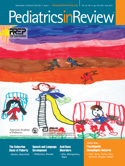 Psychogenic Nonepileptic Seizures (Pseudoseizures) | Pediatrics In ...