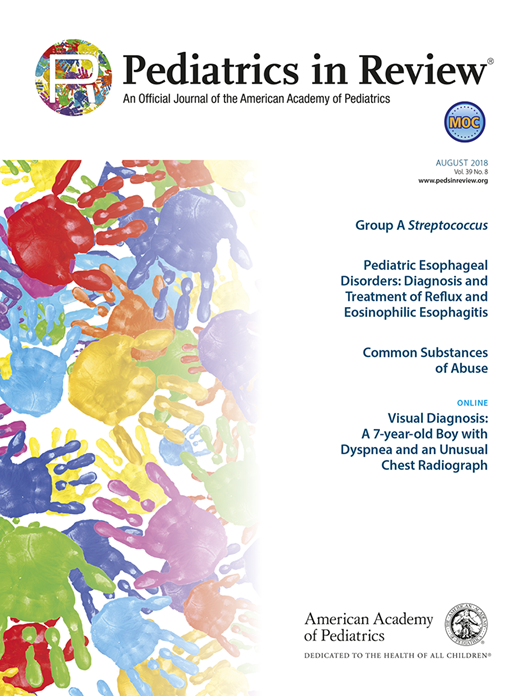 Pediatric Esophageal Disorders: Diagnosis and Treatment of Reflux and ...