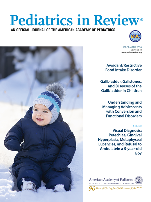 Gallbladder, Gallstones, and Diseases of the Gallbladder in Children ...