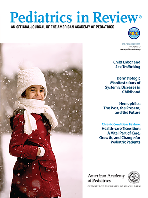 “Pain in the Neck”: Acute-Onset Neck Pain in an Adolescent Girl ...