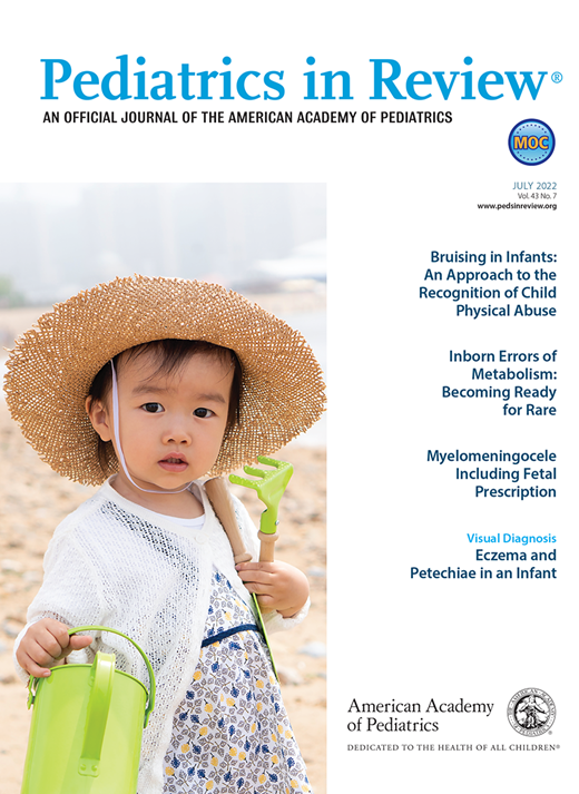 Eczema and Petechiae in an Infant | Pediatrics In Review | American ...