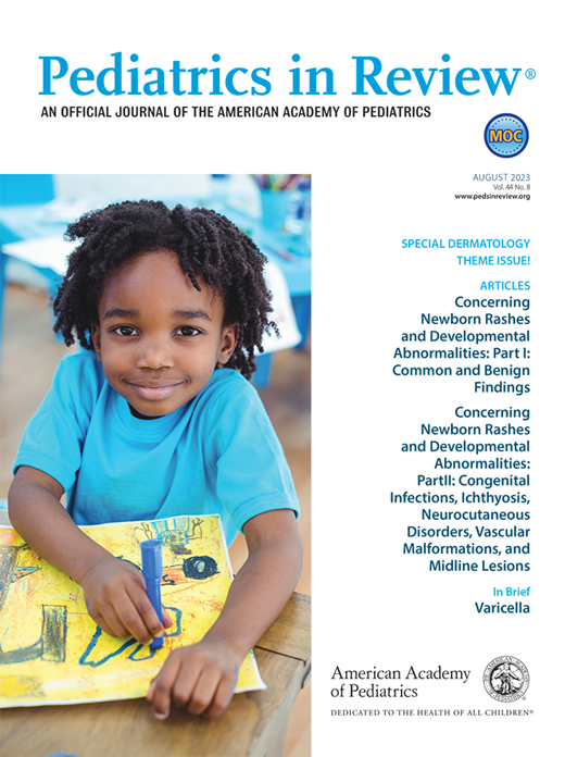 Sun-Induced Rash in a 6-year-old Girl | Pediatrics In Review | American ...