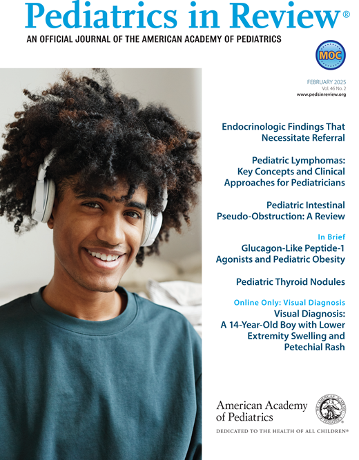 A 14-Year-Old Boy with Lower Extremity Swelling and Petechial Rash ...